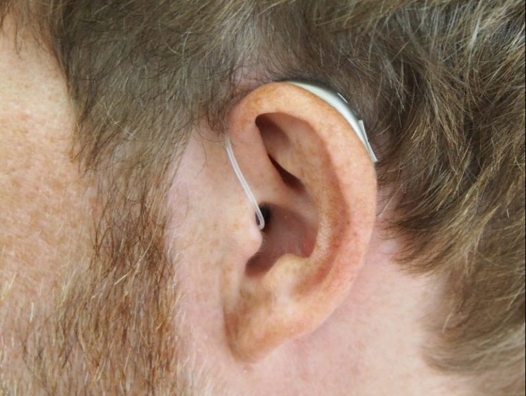 What is the Meaning of Deaf and the Types of Hearing Loss?